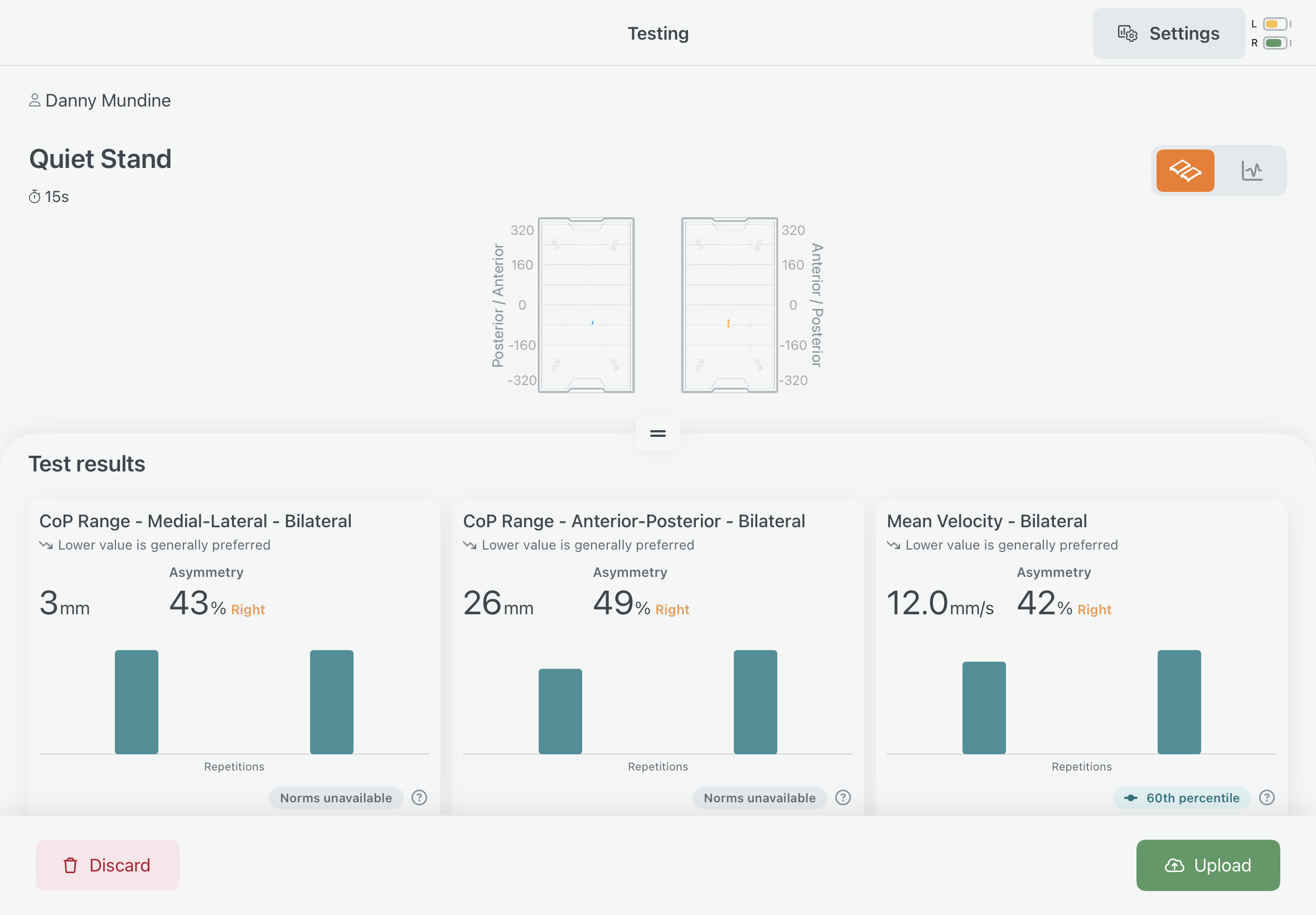 Record a balance test in ForceDecks iOS – VALD Knowledge Base